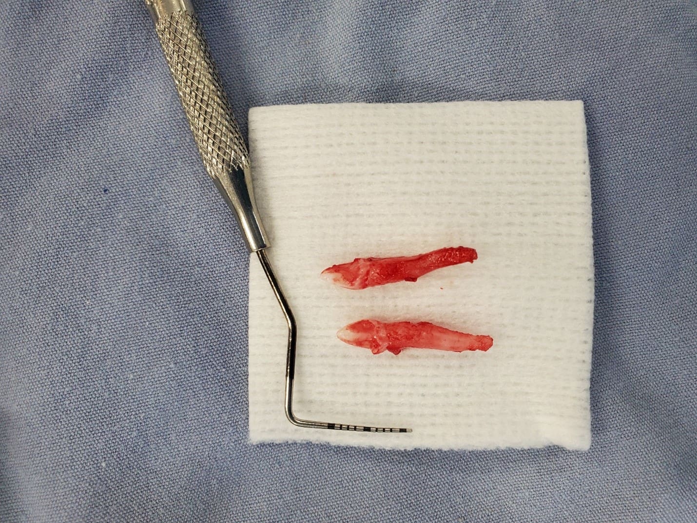 Variations in Tooth Anatomy in Dogs